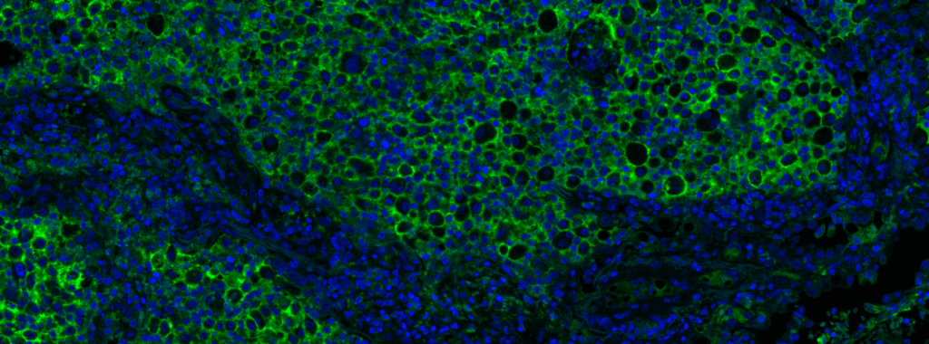 IF Immunofluorescence